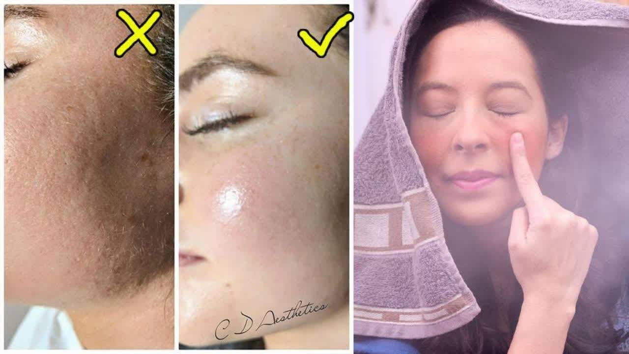 ធ្វើយ៉ាងម៉េចទើបបាត់មុន និងមុខមិនកើតមុន - TNAOT